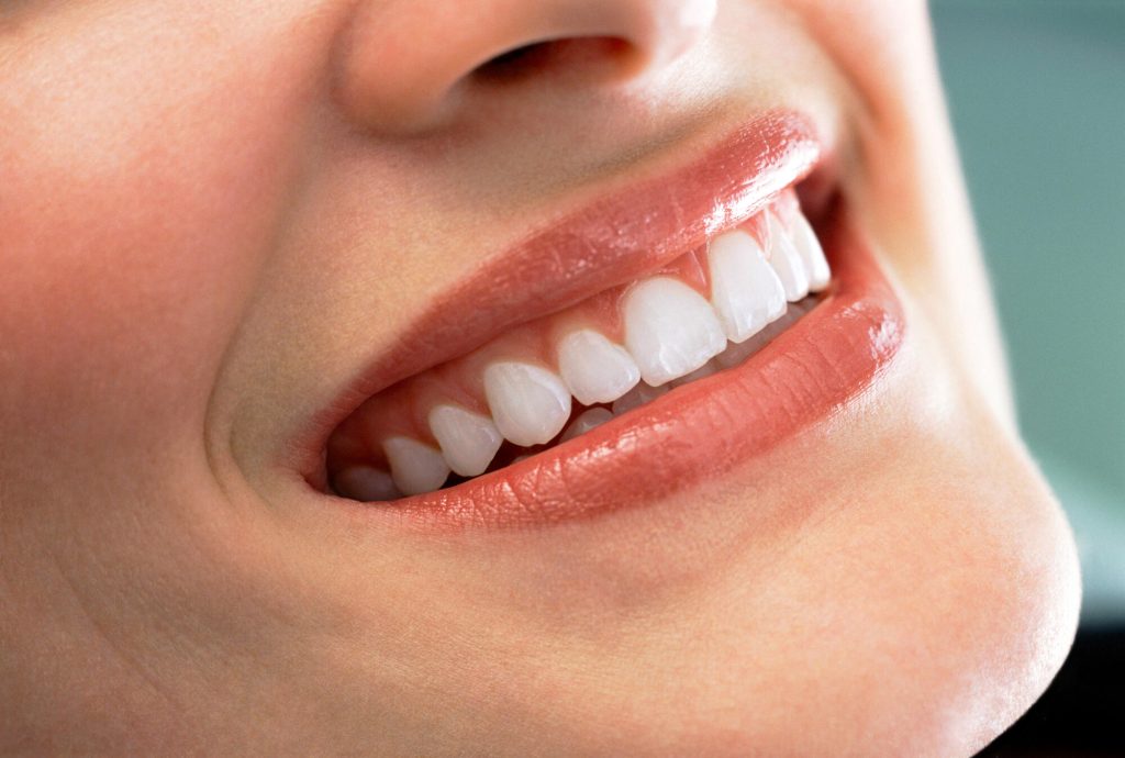 Understanding Gum Contouring Cost and Benefits